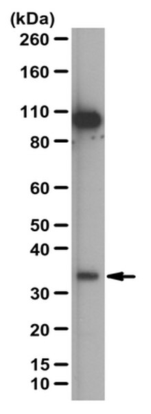 Anti-ECH1 Antibody | ABN296